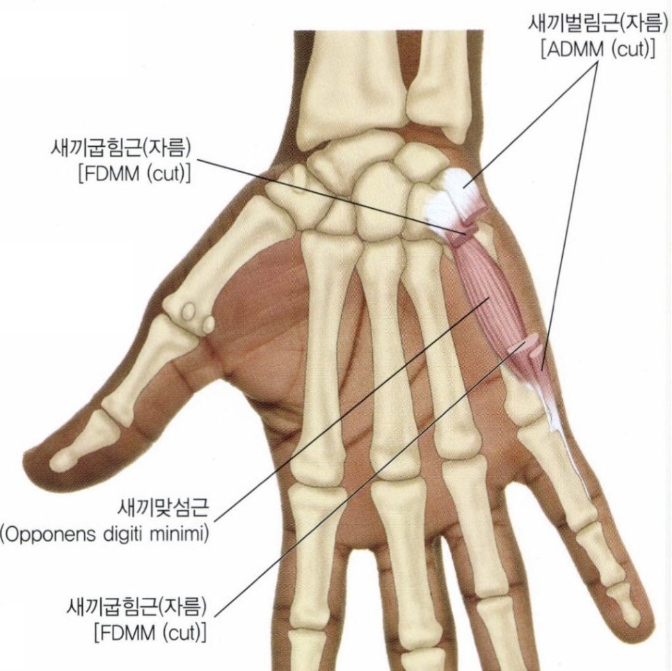 소지대립근 새끼손가락맞섬근 Opponens Digiti Minimi 아래팔 손 근육의 작용 네이버 블로그