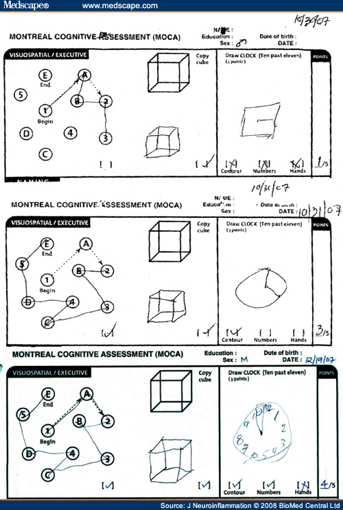 경도인지장애의 평가: MoCA-K 검사법 : 네이버 블로그