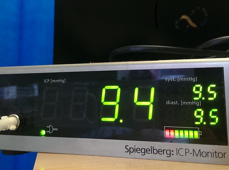 Intracranial Pressure(ICP) Monitoring, 두개내압 감시 및 측정 : 네이버 블로그